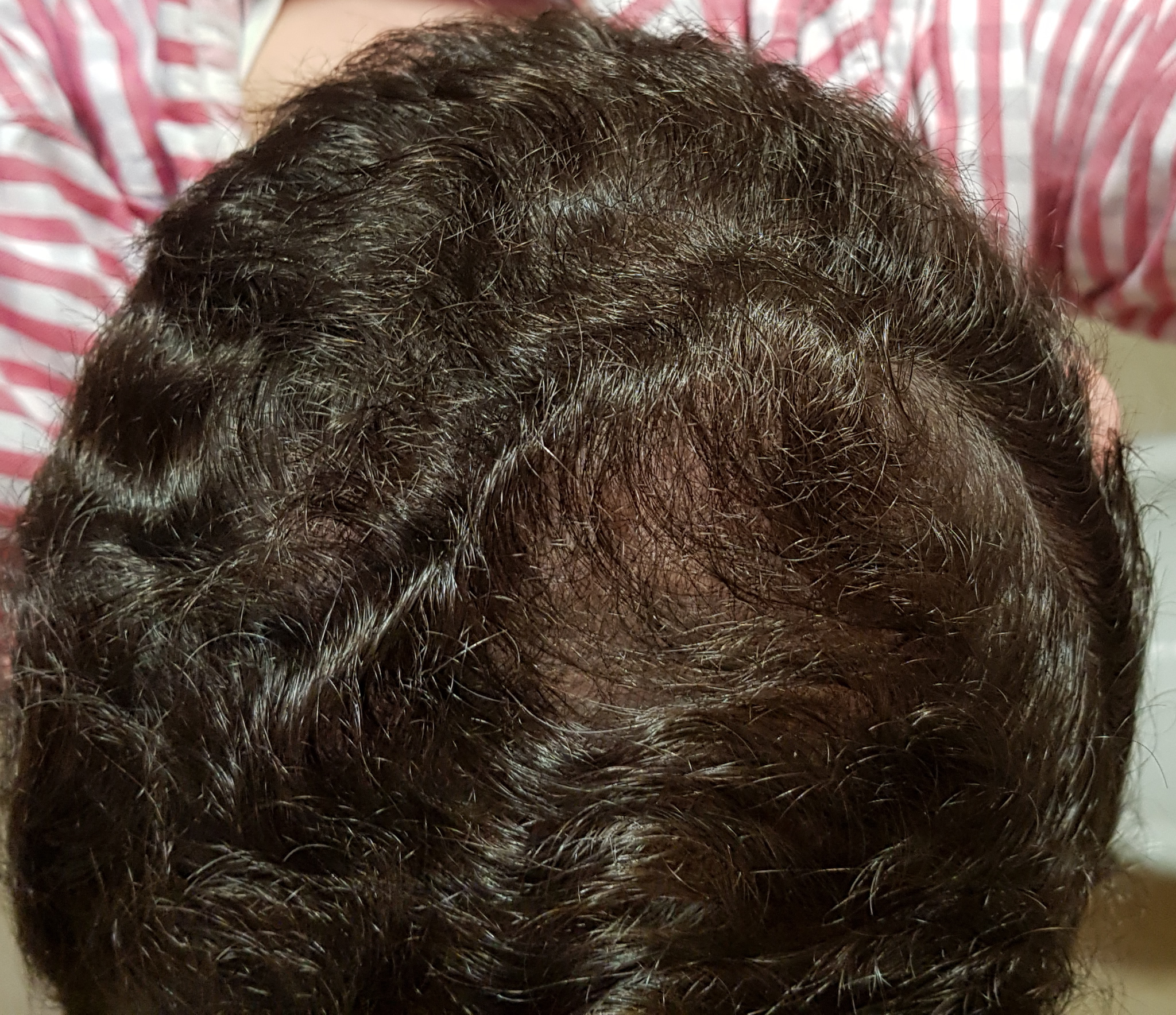 Coronilla con Doctor Hans Heinicke, Barcelona 10/05/2017 - Página 8 ...